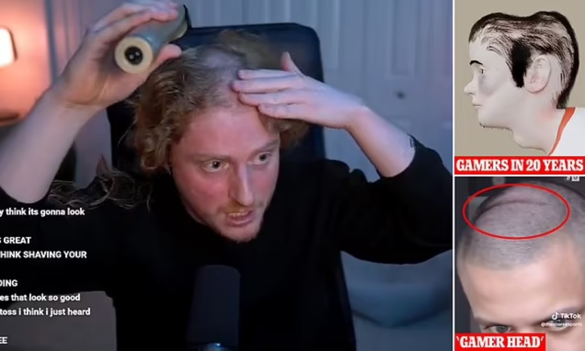 «سر گیمر» فرو رفتگی عجیب ایجاد شده روی سر گیمرها چیست؟ + ویدیو